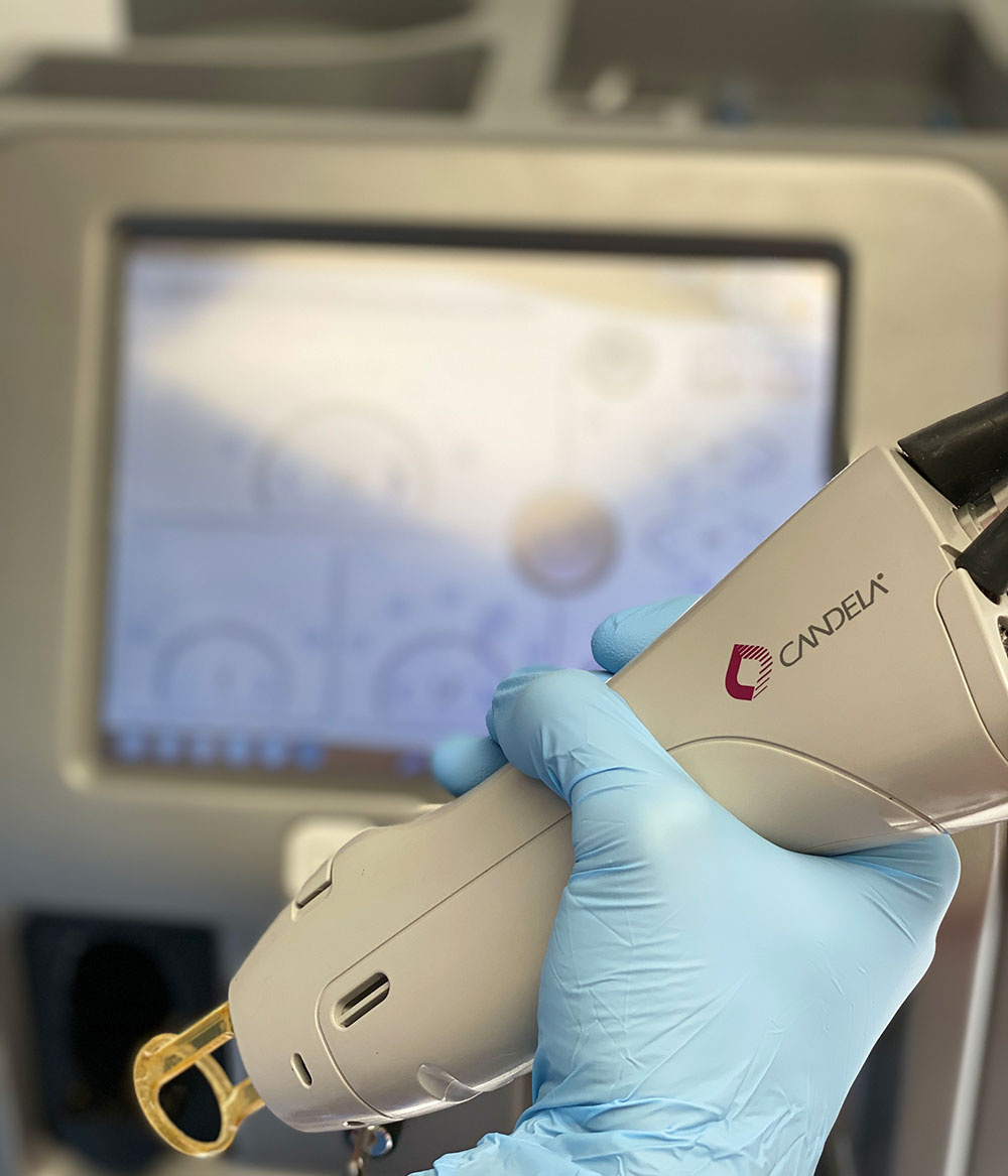 Prenota il tuo trattamento Epilazione Laser Viso - Dr. Franco Barbazza